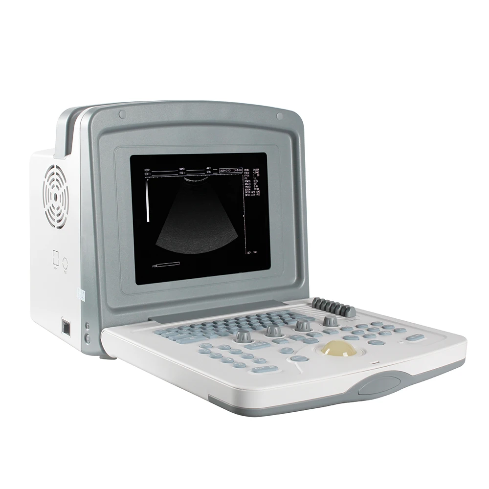 Professional-Full-Digital-Color-Doppler-Ultrasonic-Diagnostic-System ...