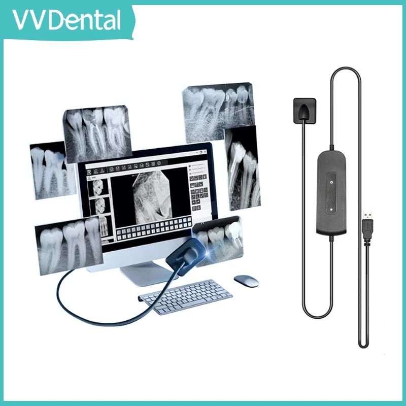 VVDental Dental Sensor X-Ray Radiovisiograph Digital Sensor Intraoral ...