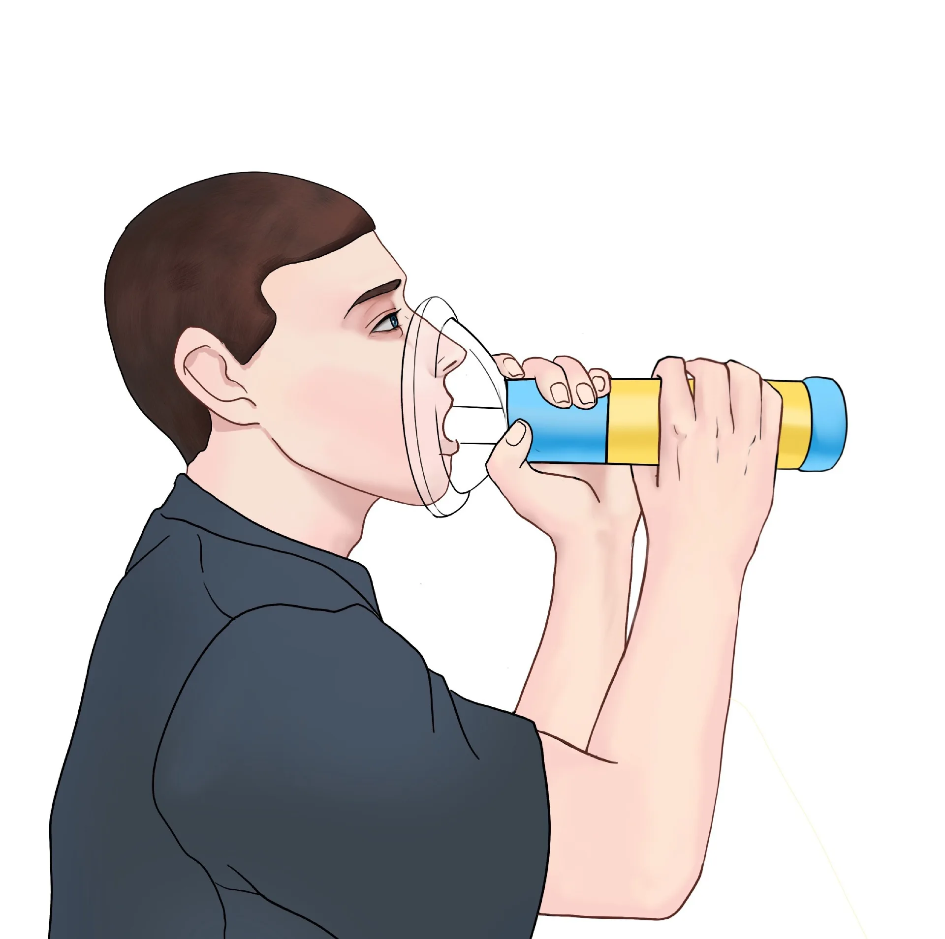 Upgrade-Portable-Anti-Choking-Device-Choking-Emergency-Life-Saving ...