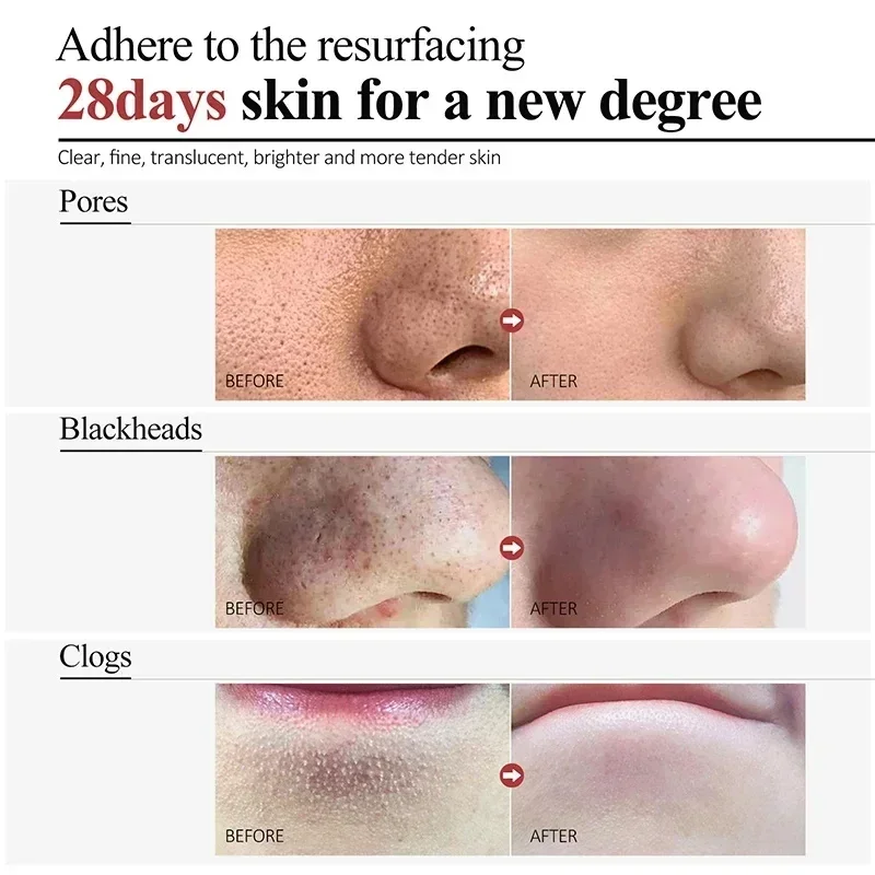 Salicylic Acid Pore Shrinking Cream – D.I.Y Salon Supplies