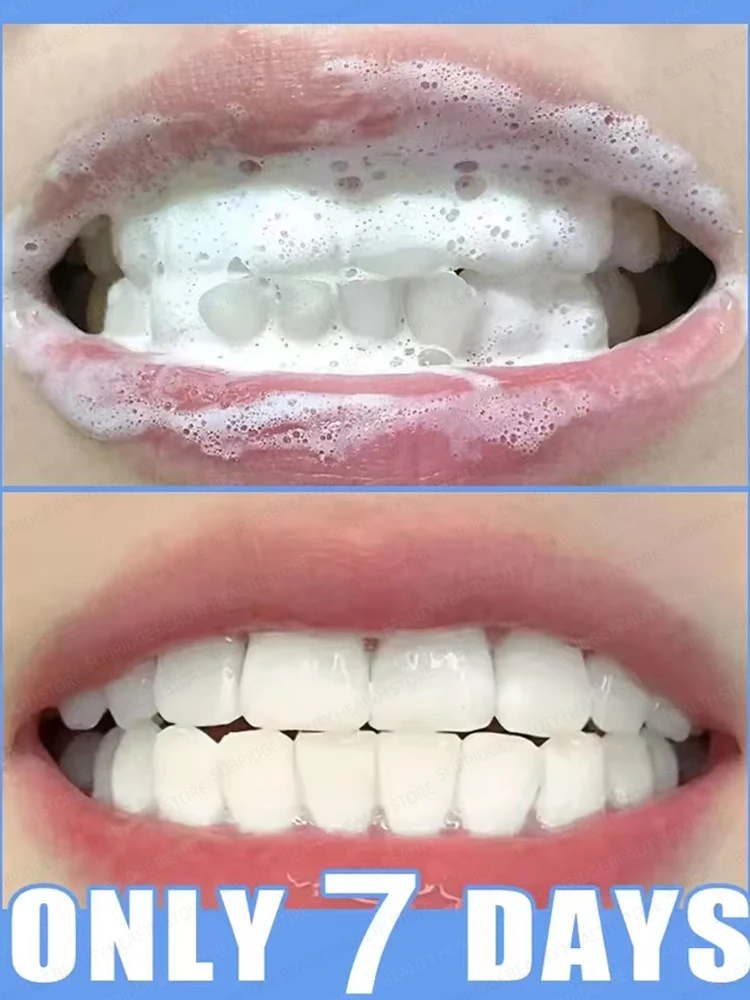 Tartar removers dissolve tartar and remove stains - AliExpress 66