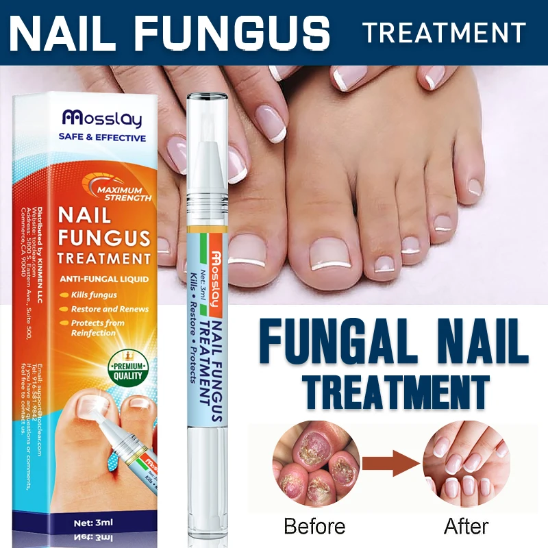 Mosslay-Nail-Fungus-Treatment-Essence-Serum-Hand-Foot-Care-Fungal ...