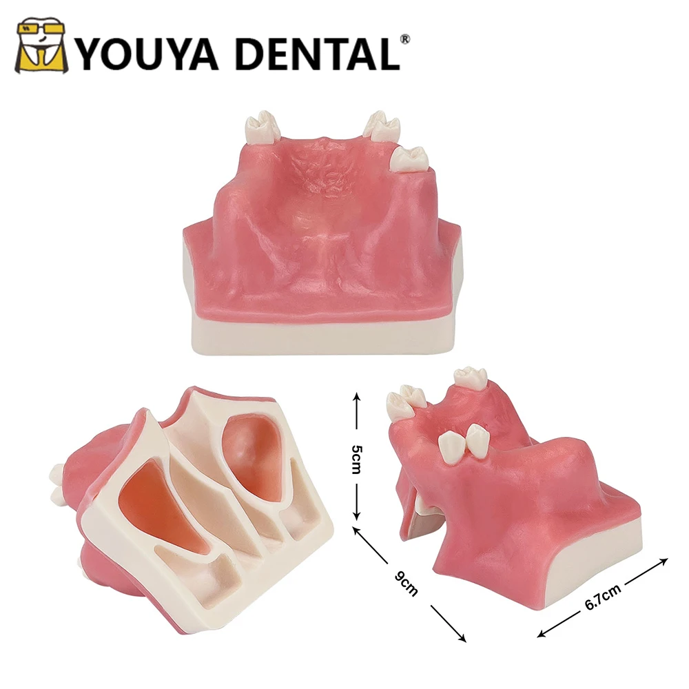 Dental Implant Teaching Model Maxillary Sinus Teeth Model for Dentist ...