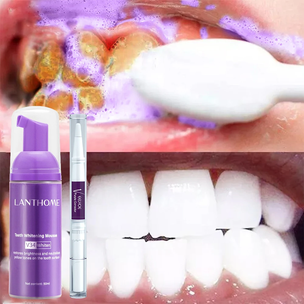 V34-blanqueador-Dental-Mousse-de-limpieza-bucal-cuidado-Dental-pasta-de ...