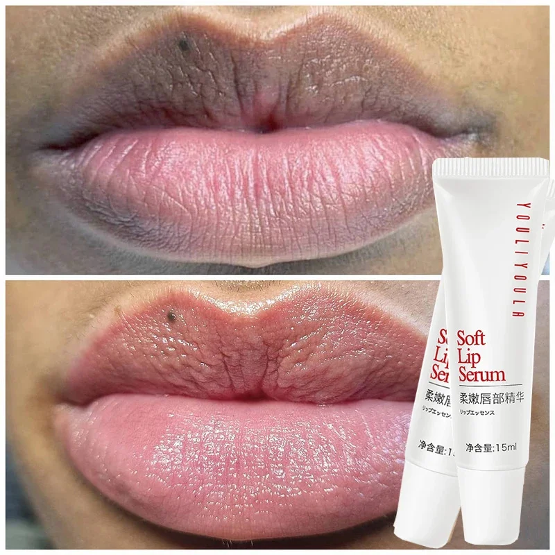 Lip-Pink-Fresh-Lightening-Bleaching-Cream-Treatment-Remove-Dark-Smoke ...