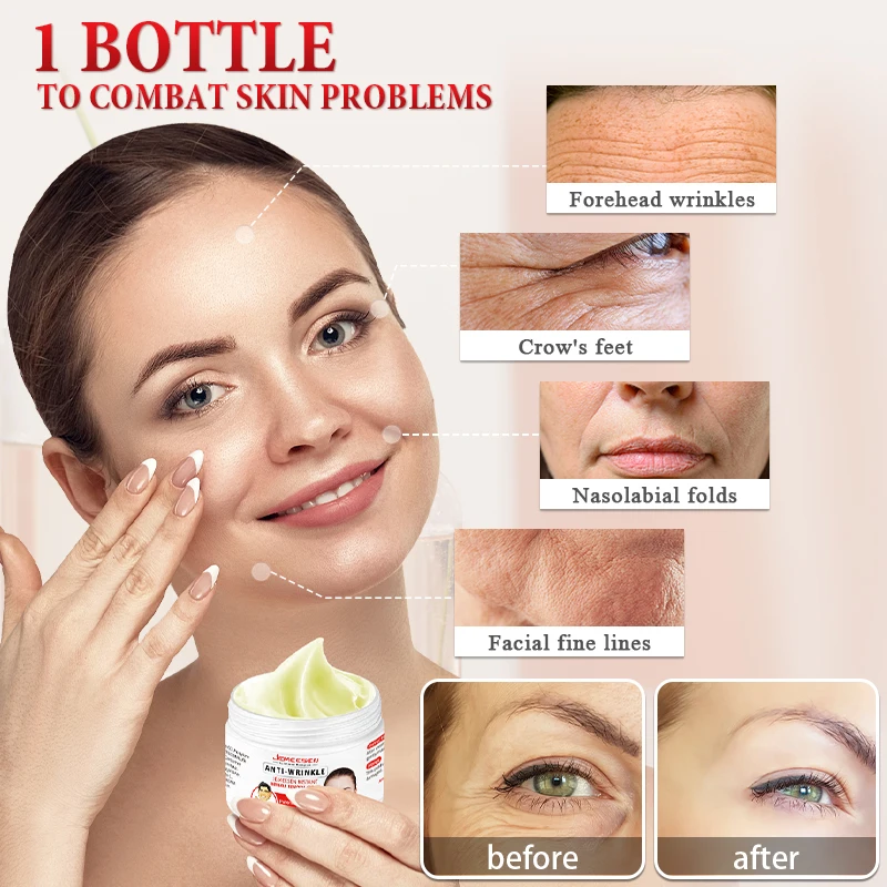 Hemorrhoid Cream For Wrinkles