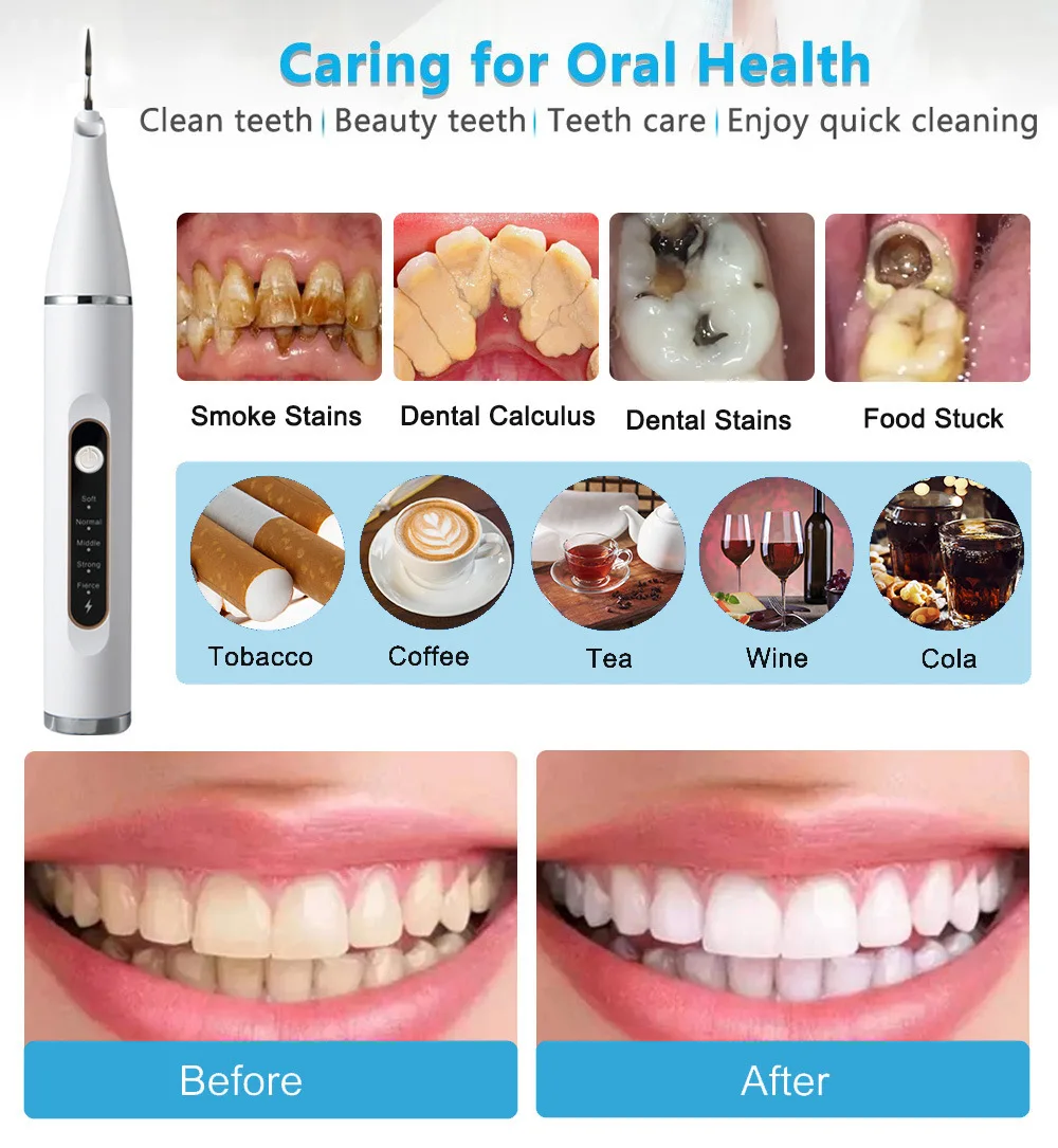 Nettoyeur De Dents Électrique Ultrasonique 5 Modes - AIHONTAI ...