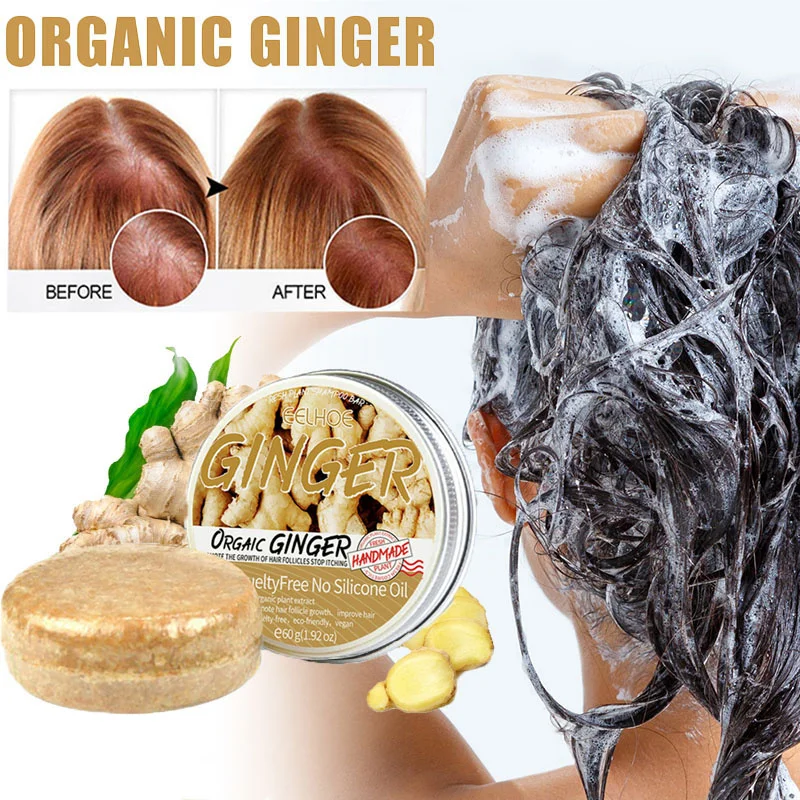 Ginger-Hair-Growth-Soap-Anti-Hair-Loss-Fast-Growing-Shampoo-Bar ...