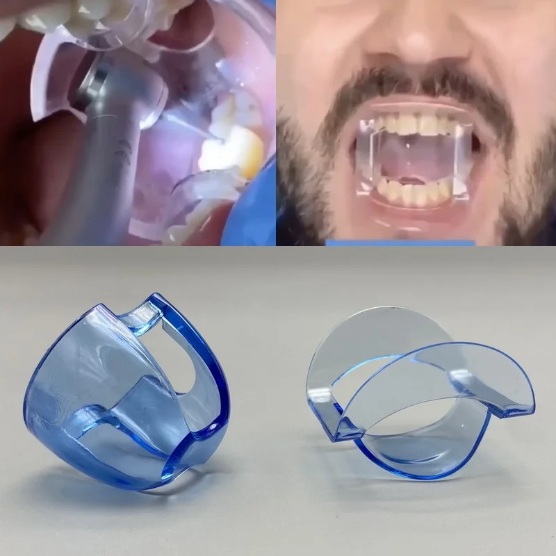 Dental-Mouth-Opener-Gag-Anterior-Posterior-Lip-Cheek-Retractor-Expander ...