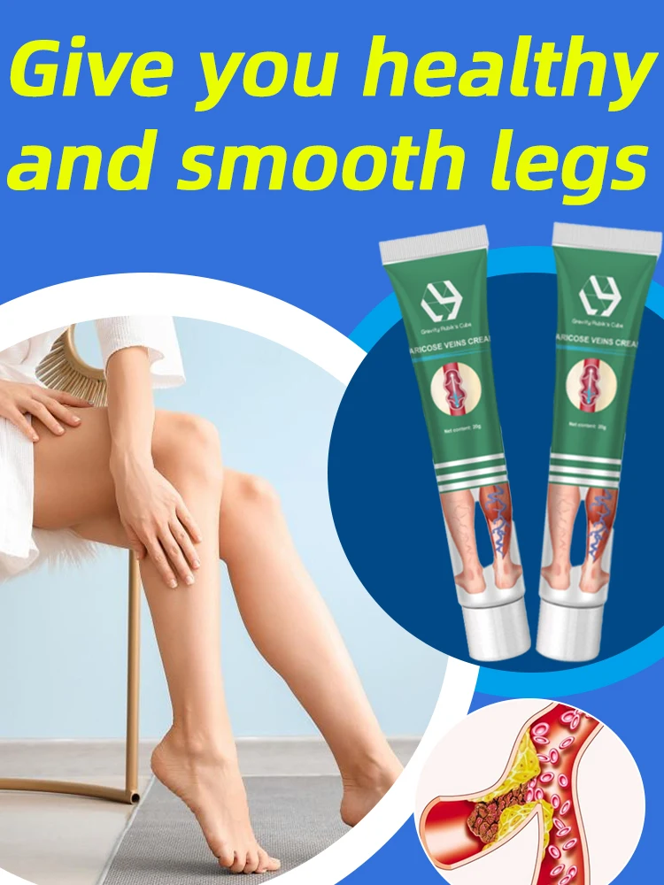 Varicose-cream.jpg