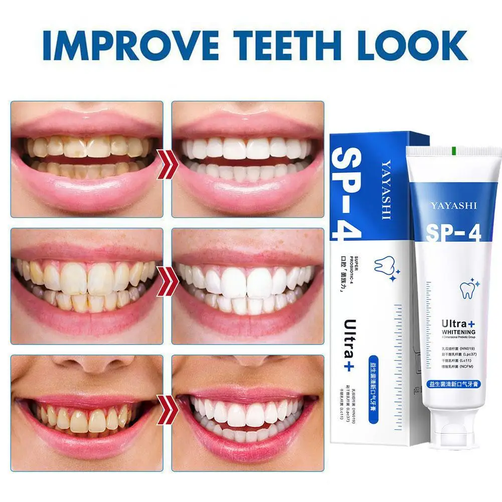 How To Get Super White Teeth