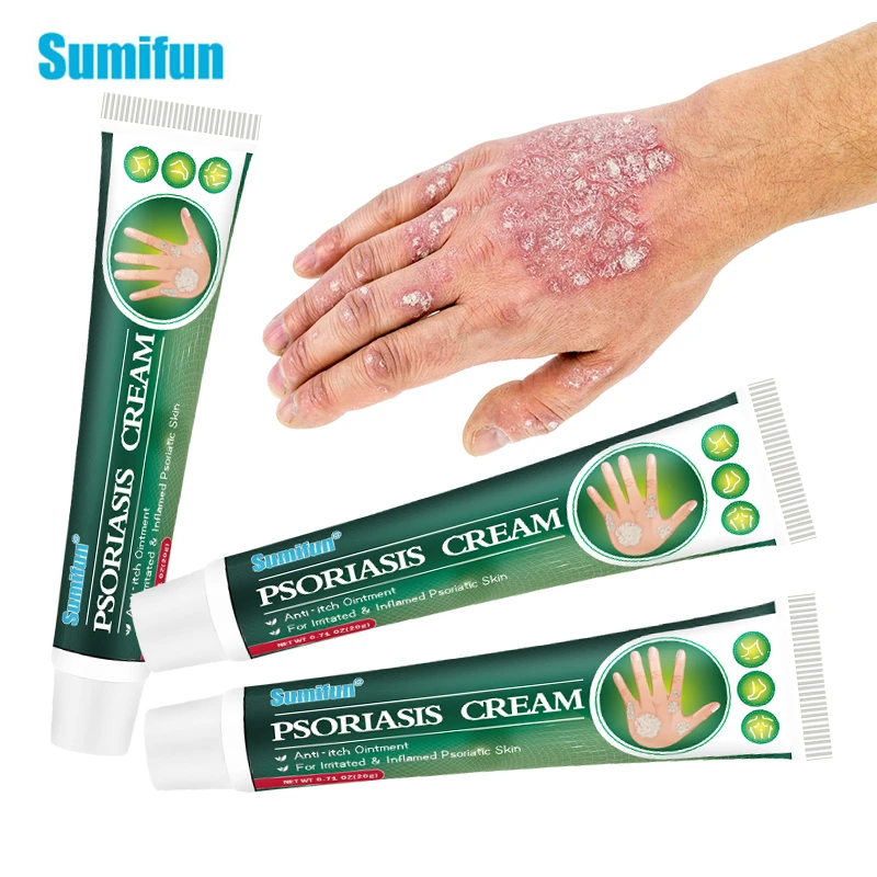1-2-3-Sumifun-Chinese-Psoriasis-Medicine-Cream-Skin-Care-for-Dermatitis ...