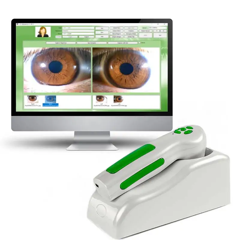 Professional-Eye-Iridology-Camera-HD-12MP-Iris-Analyzer-for-Beauty ...