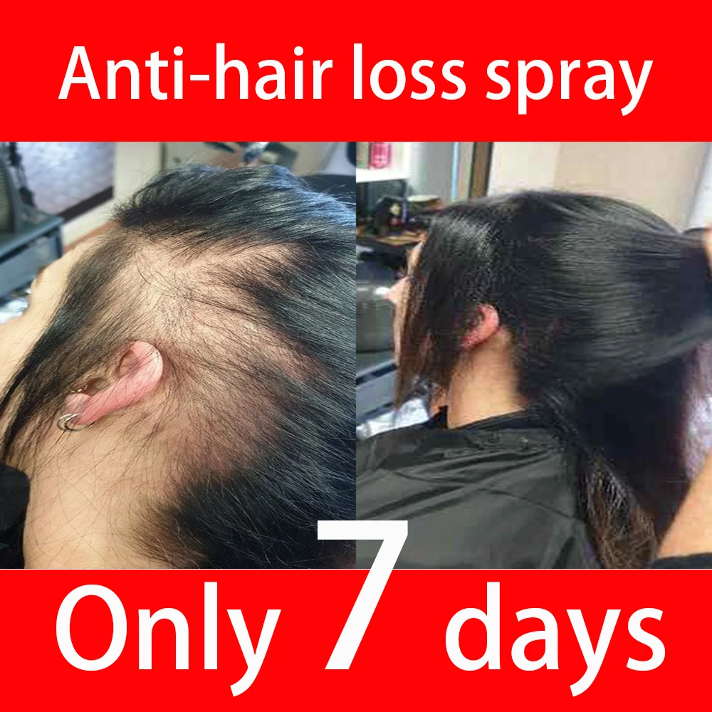 Sd643ca09574e44b79181bc6ac4fa5a97w.jpg