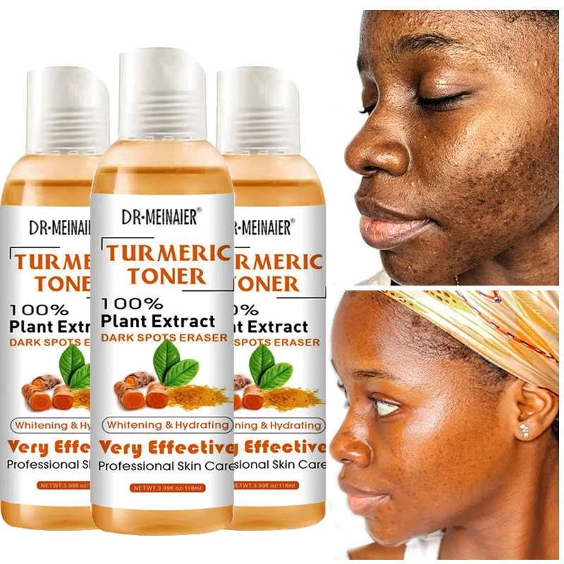 3pcs-Turmeric-Toner-Brightening-Face-Serum-Dark-Corrector-Moisturizing ...