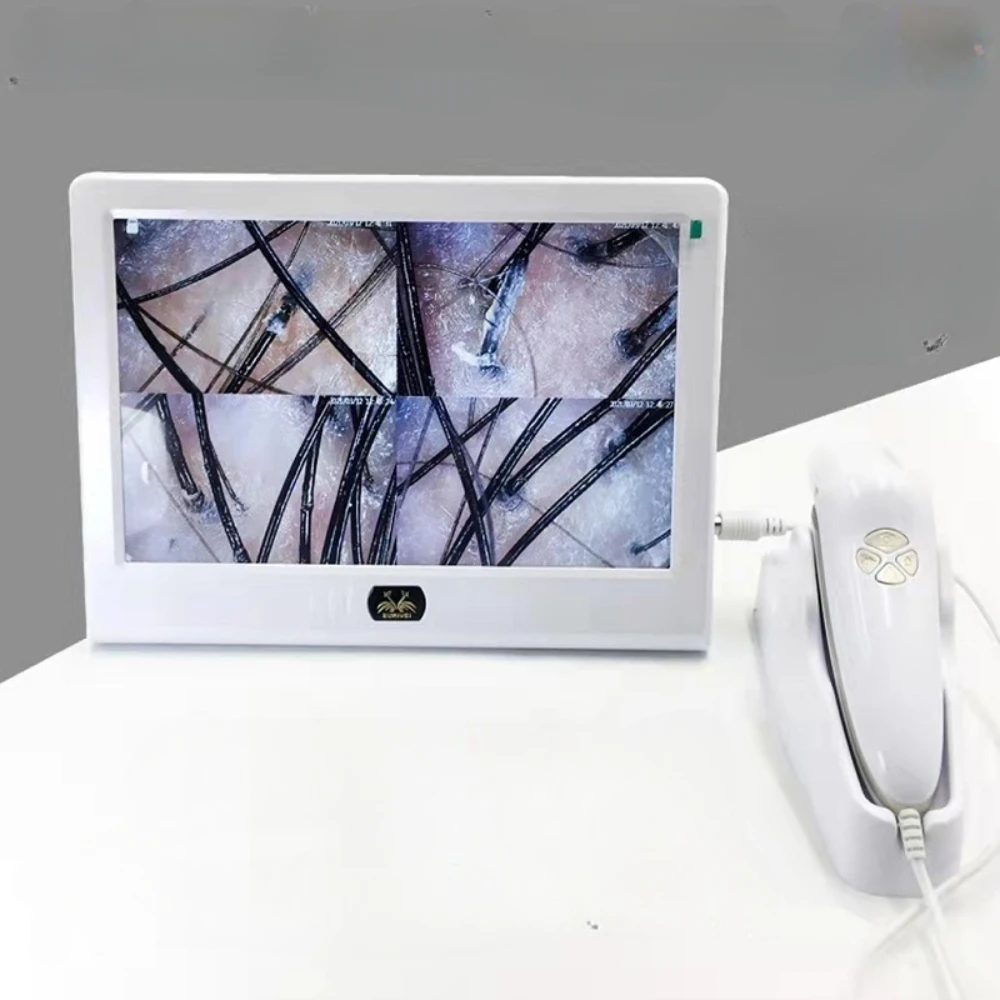 Skin-Analyzer-Machine-Scalp-Detector-Portable-Rechargeable-Hair ...