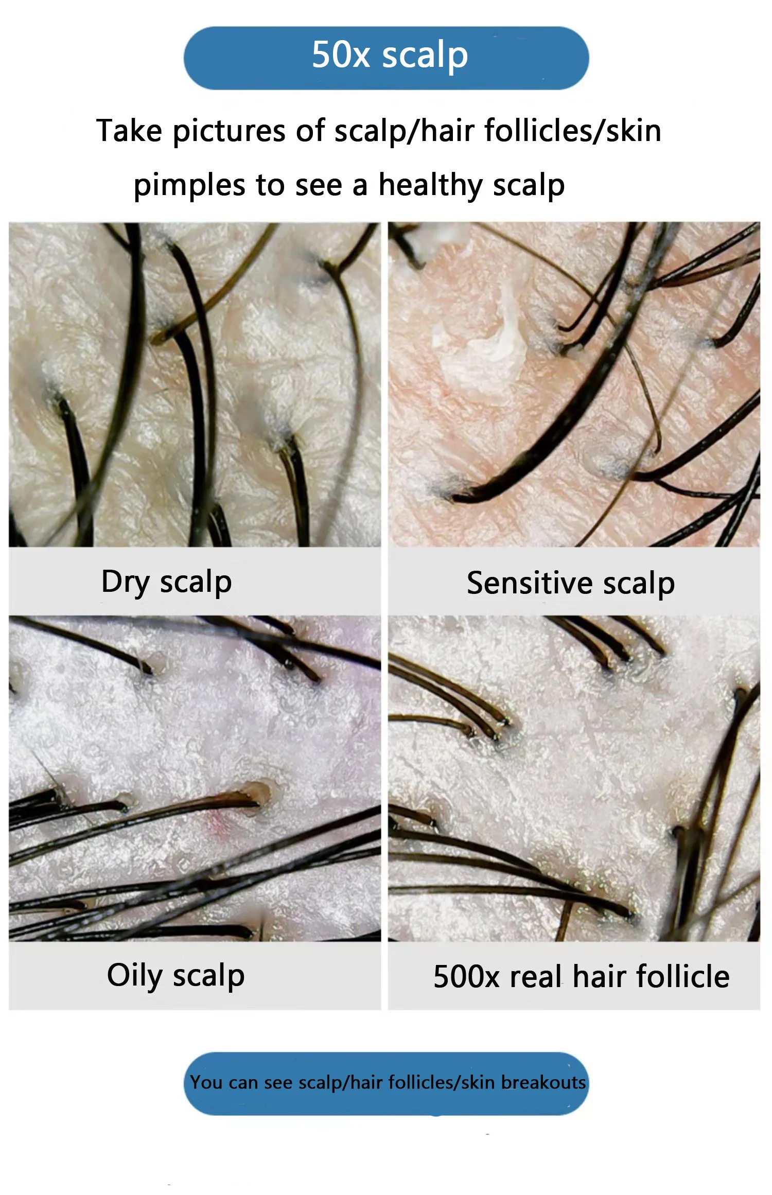 Hair Follicle Microscope