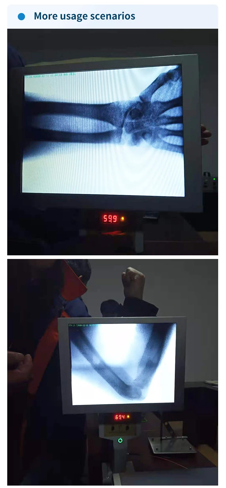 10 Hüvelykes Led Tv-Kijelző Hordozható Röntgenfelügyeleti Rendszer ...