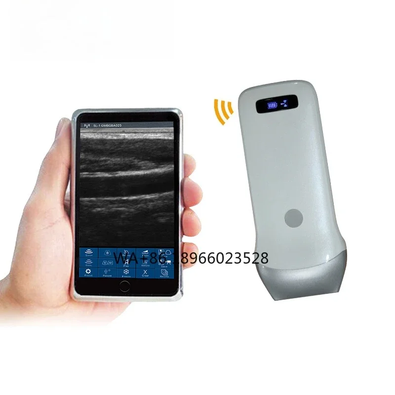 Exploring the Healson Ultrasound: A Revolution in Portable Medical Imaging