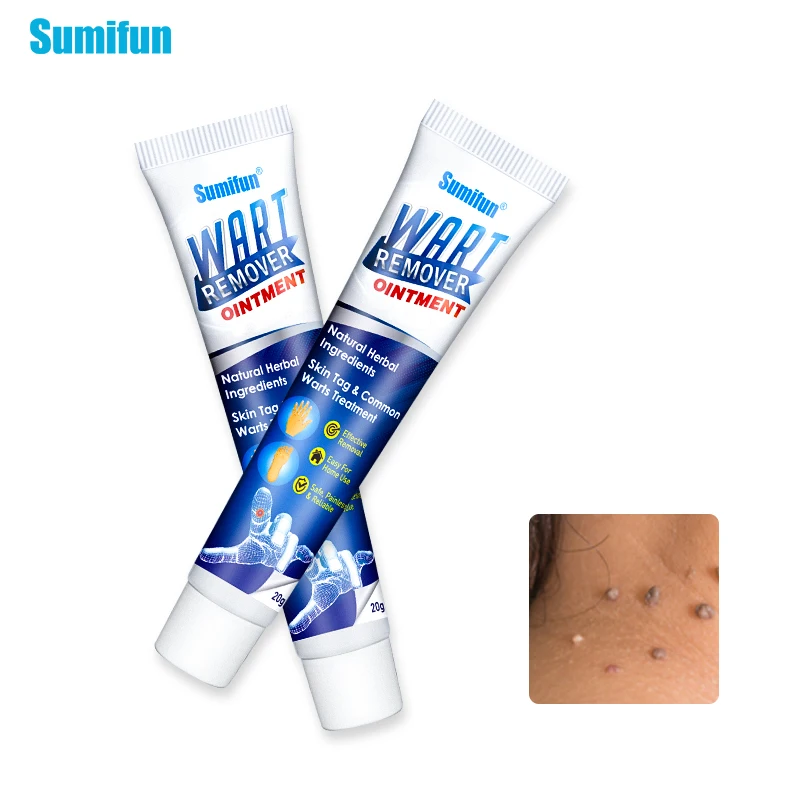 Sumifun-20g-Wart-Removal-Body-Warts-Treatment-Cream-Skin-Tag-Remover ...