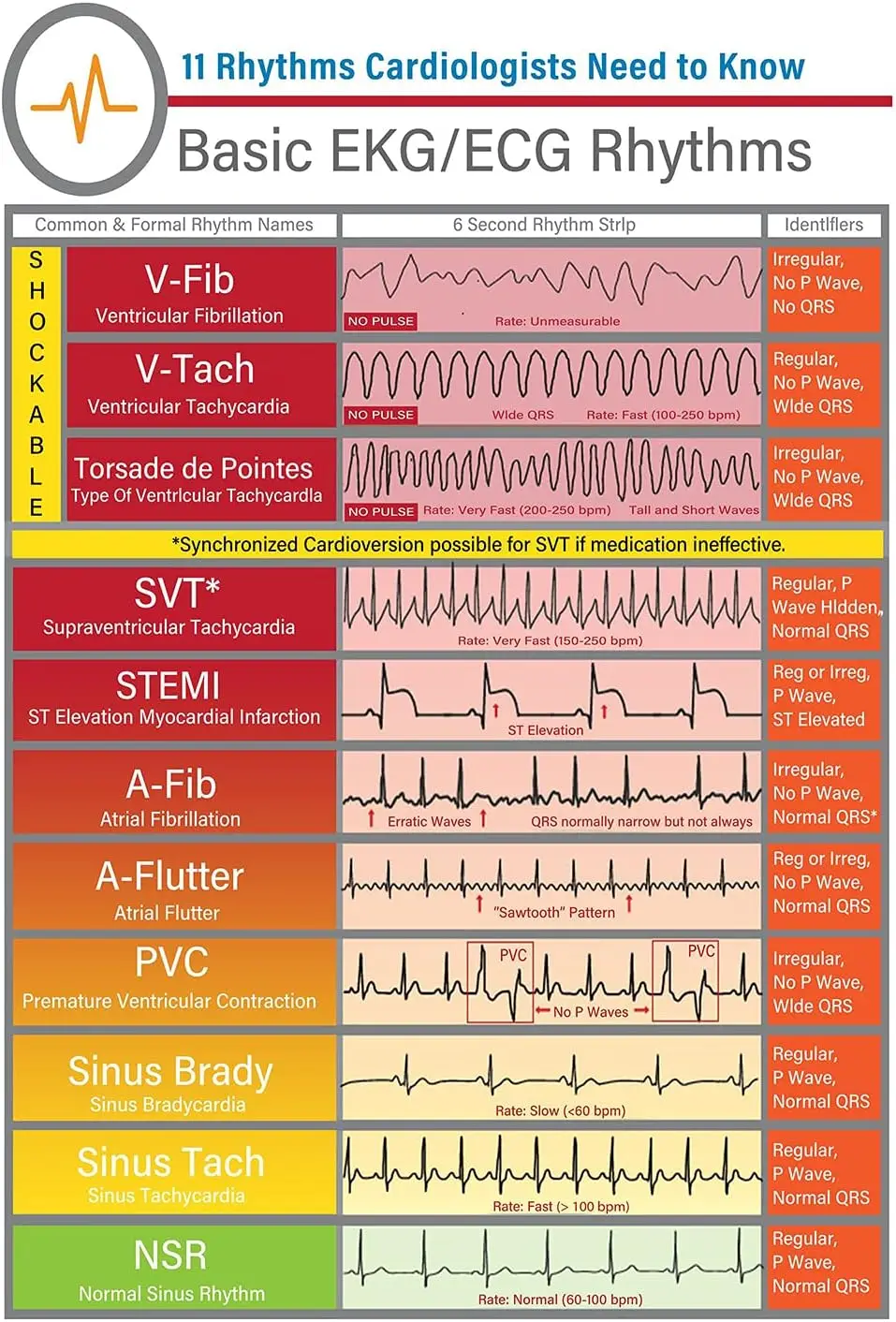 Cardiology-Knowledge-Posters-Basic-Ekg-Ecg-Rhythms-Metal-Signs-School ...