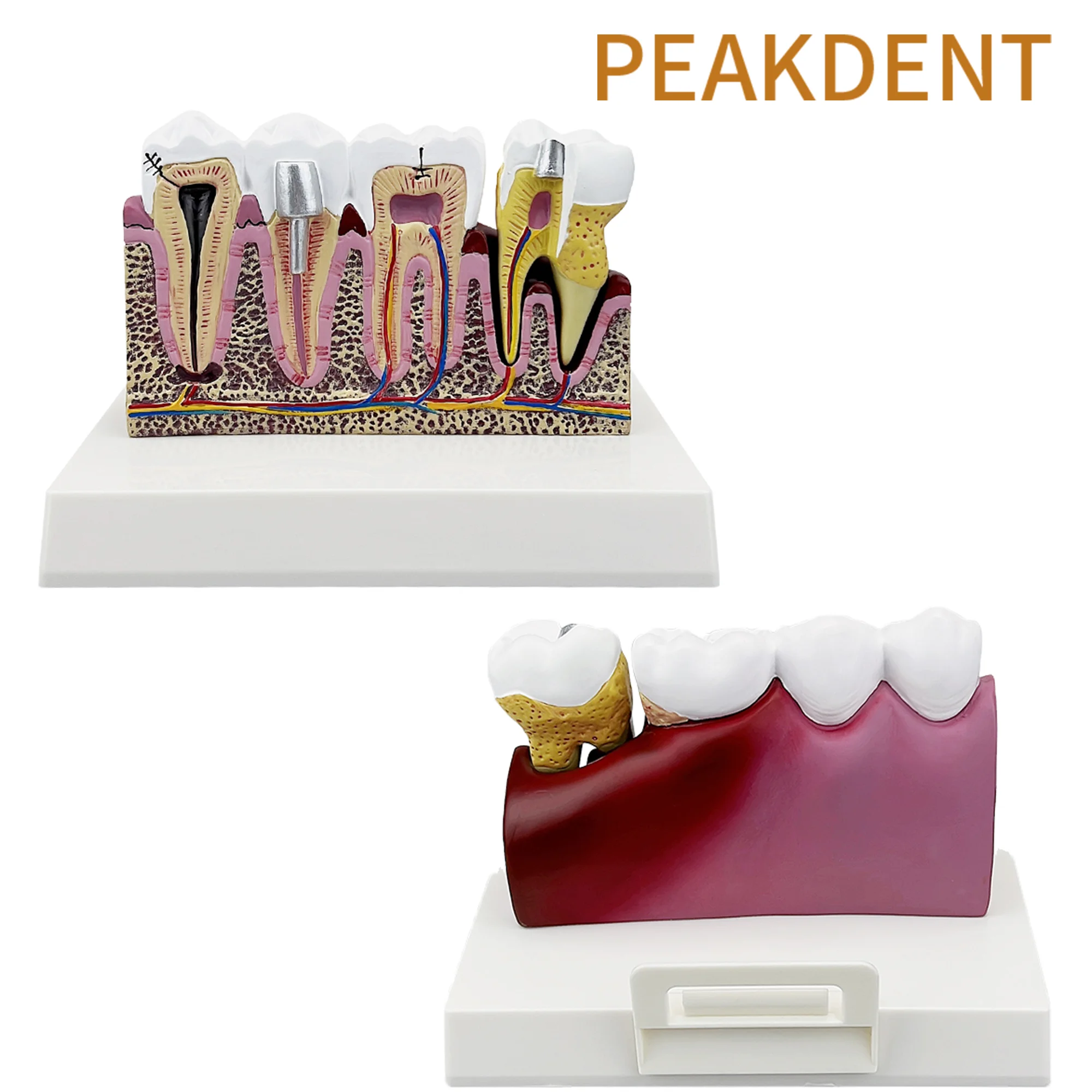Modelo-de-ense-anza-anat-mica-de-dientes-orales-dentales-est-ndar ...