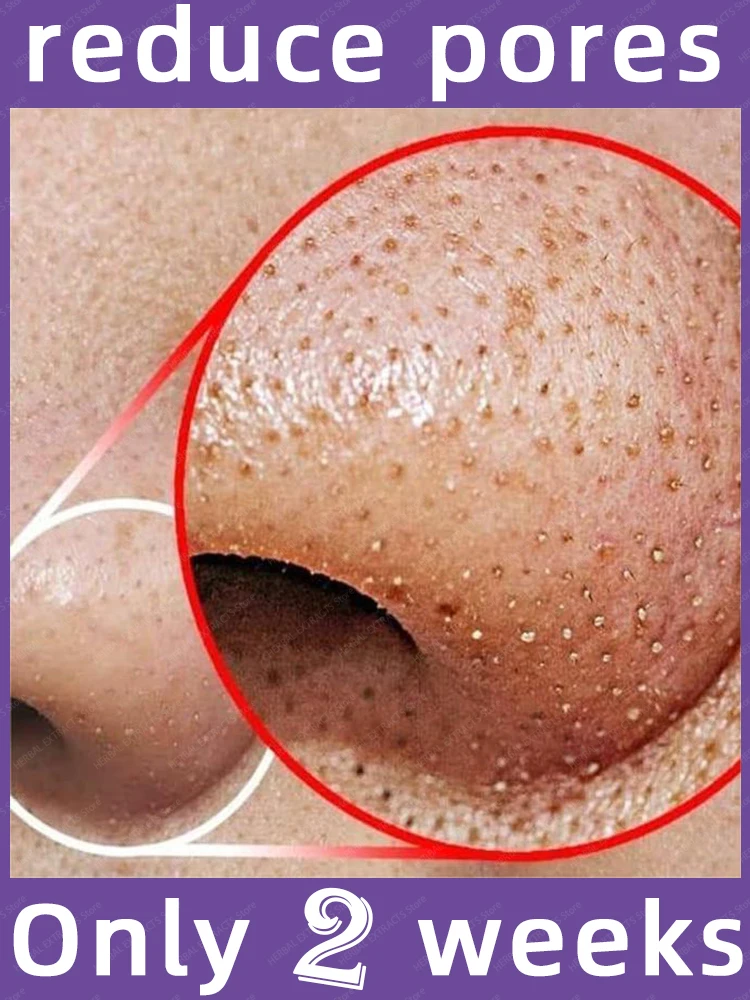 Pore-Minimizing-Serum-Shrink-Pores-To-Make-Skin-Smooth-And-Delicate ...