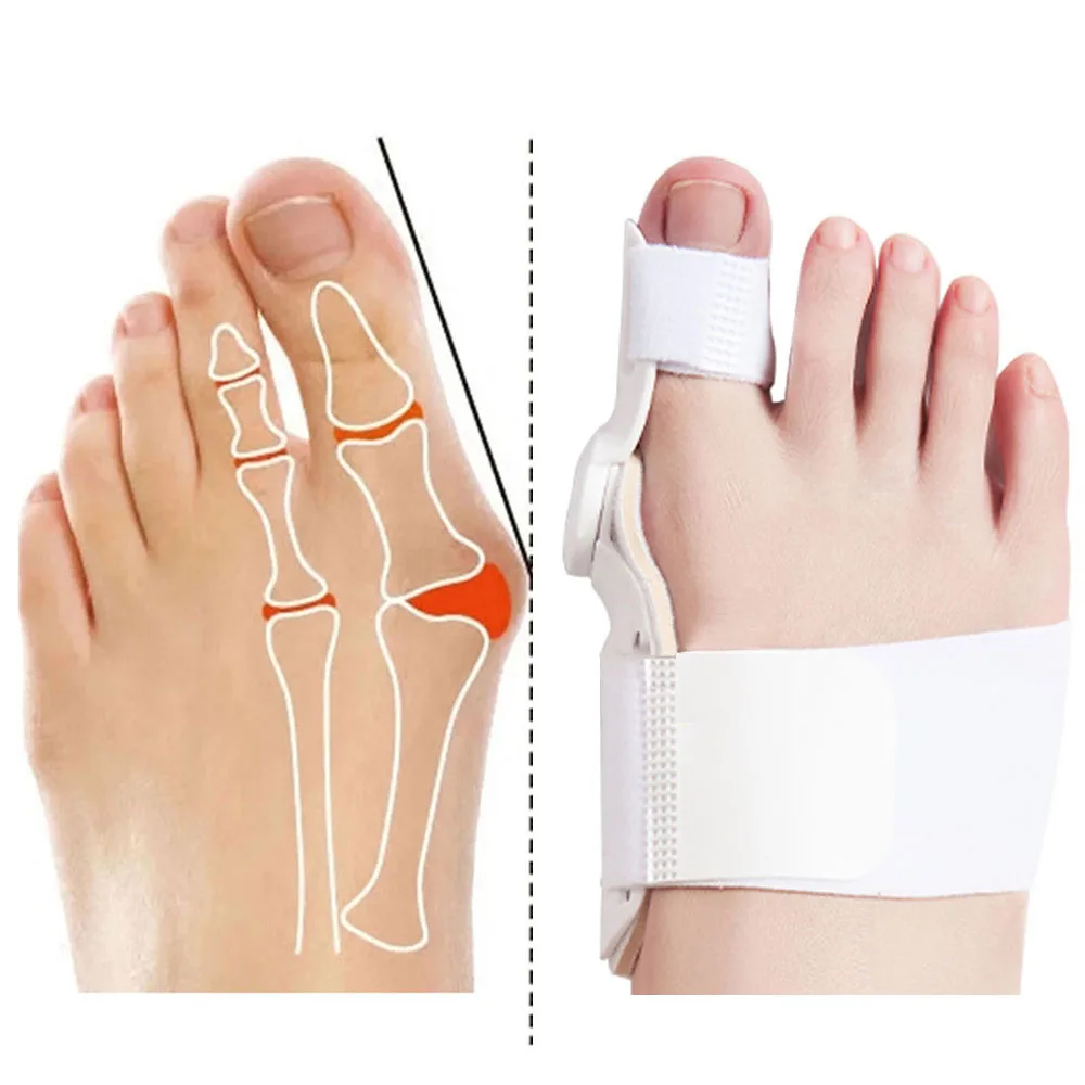 2Pcs-1Pair-Toe-Separator-Hallux-Valgus-Bunion-Corrector-Orthotics-Feet ...