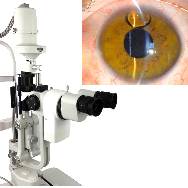 Slit-Lamp-Sistema-de-C-mera-Digital-Slit-Lamp-Imaging-Module-para ...