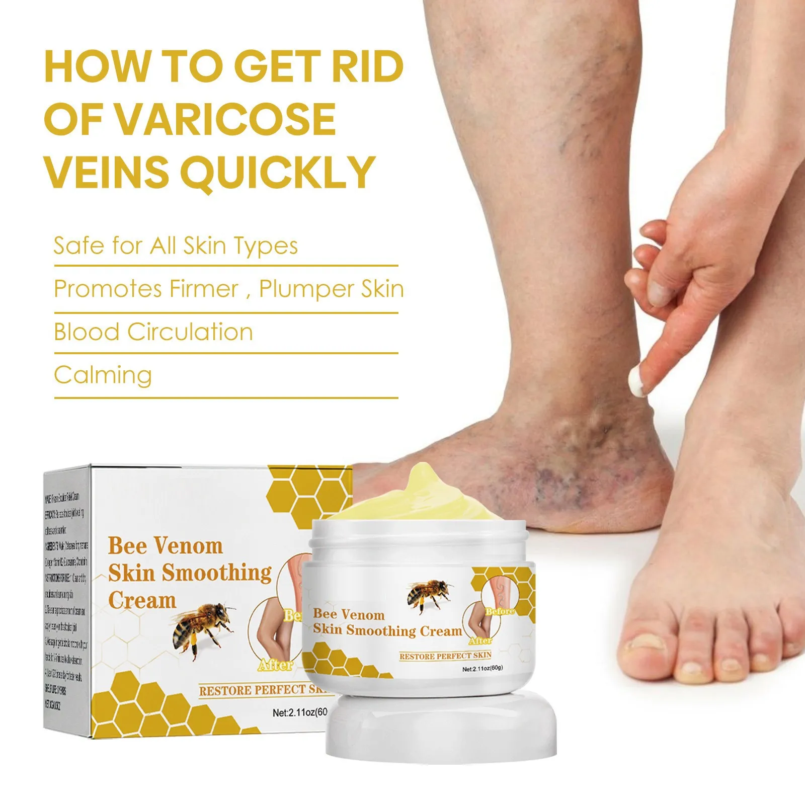 Bee-venom-vein-repair-cream-reduces-varicose-veins-promotes-blood ...
