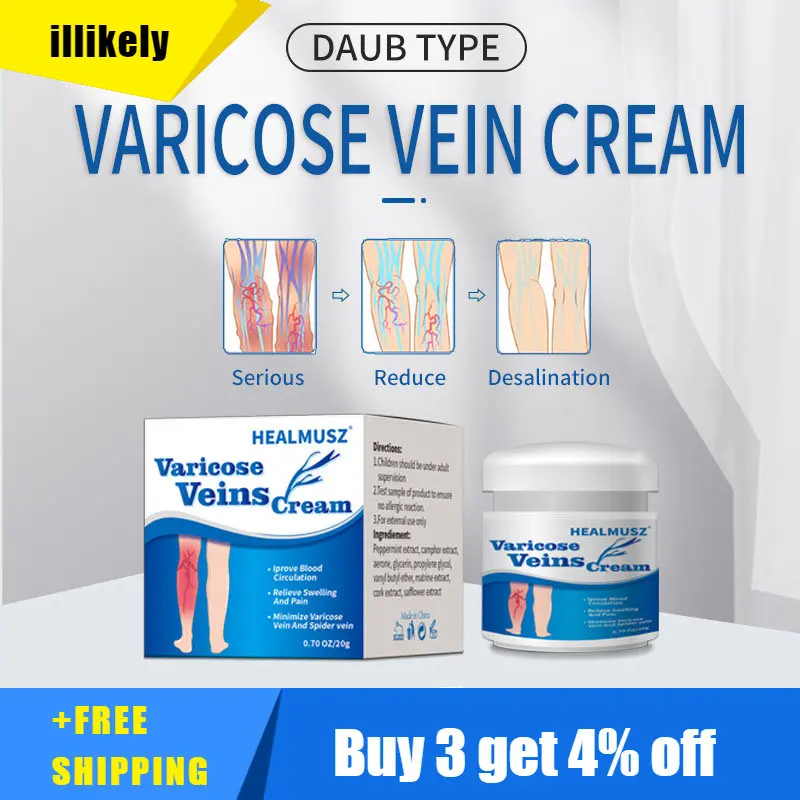 Varicose-Veins-Relief-Cream-Vasculitis-Phlebitis-Spider-Pain-Relief ...