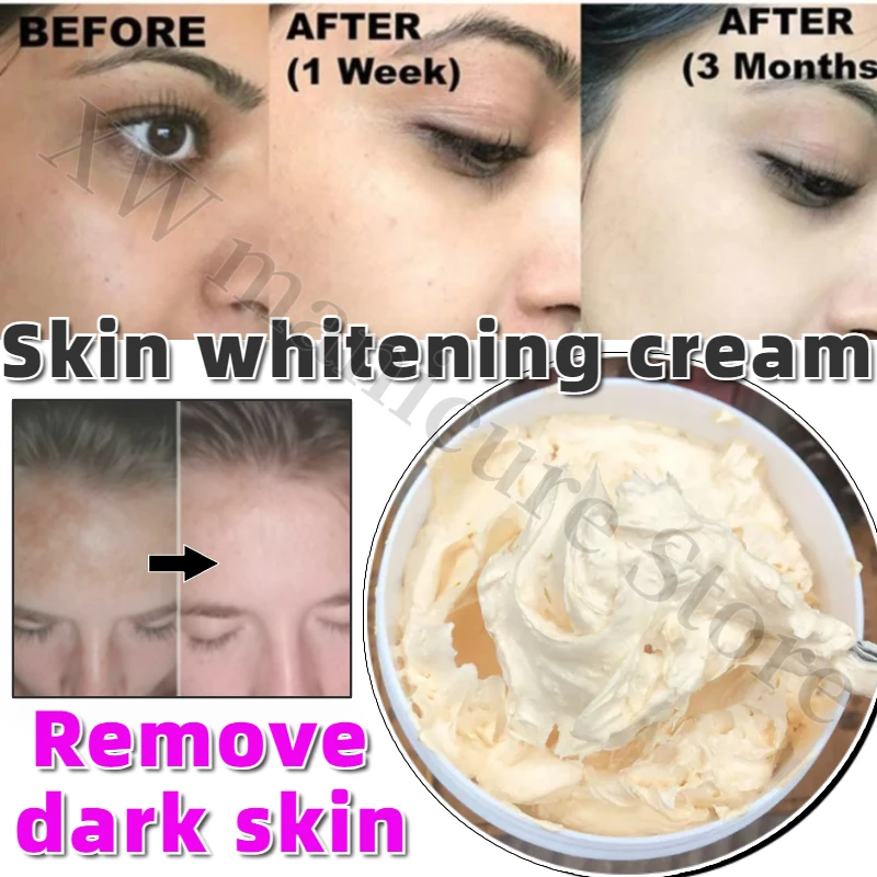 Strong-Whitening-Cream-for-Face-and-Neck-Whitening-Hands-and-Feet ...