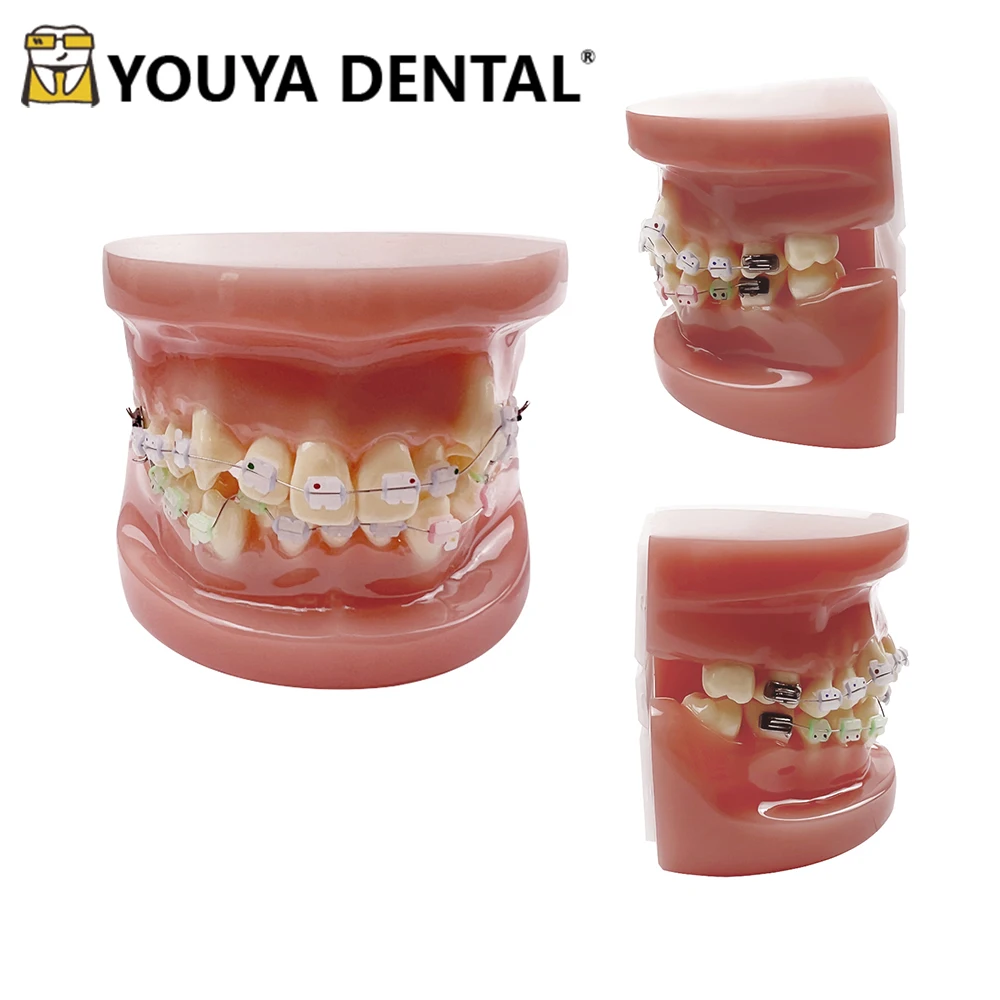 All-Ceramic-Orthodontic-Teeth-Model-Dental-Teaching-Model-for-Dentist ...