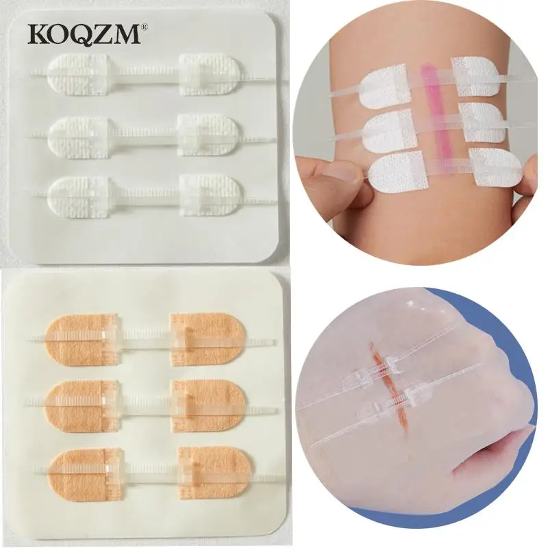 2Pcs-3pcs-Band-Aid-Zipper-Tie-Wound-Closure-Patch-Hemostatic-Patch ...