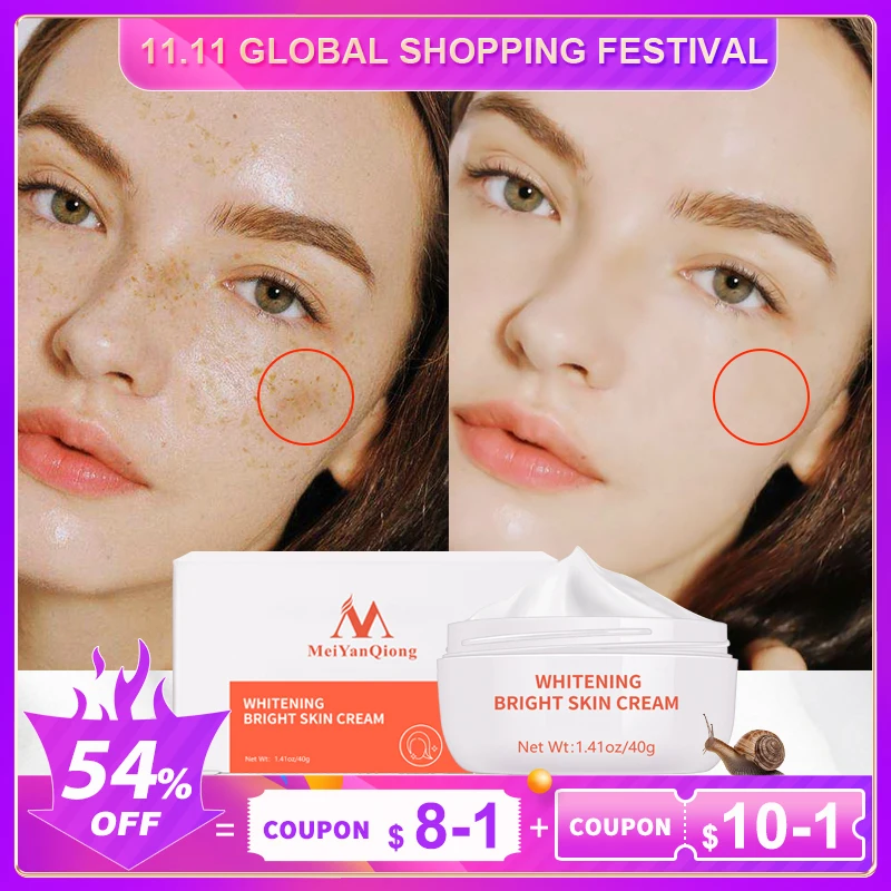 Moisturiser-Face-Whitening-Freckle-Cream-Remove-Acne-Spots-Melanin-Dark ...