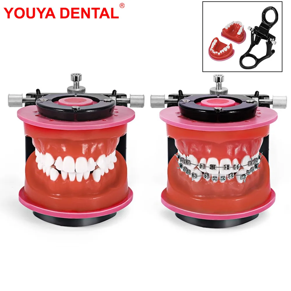Dental-Orthodontic-Treament-Model-Standard-Orthodontic-Model-Traning ...