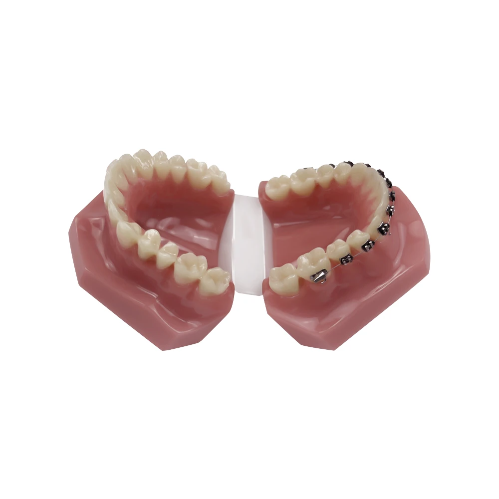 Retainer For Teeth Heart Designs