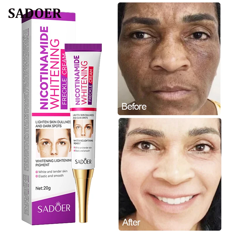 Nicotinamide-Dark-Spots-Removal-Whitening-Cream-Brighten-Freckle ...
