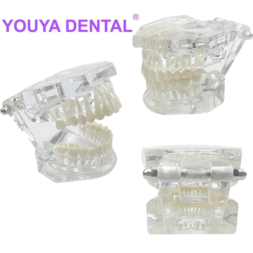 Clear-Dental-Standard-Teeth-Model-Typodont-Jaw-Model-Teaching-Study ...