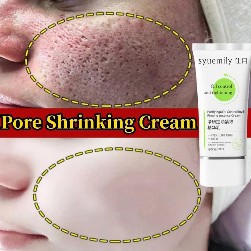 Salicylic-Acid-Pore-Shrinking-Cream-Reduce-Large-Pore-Tighten-Refining ...