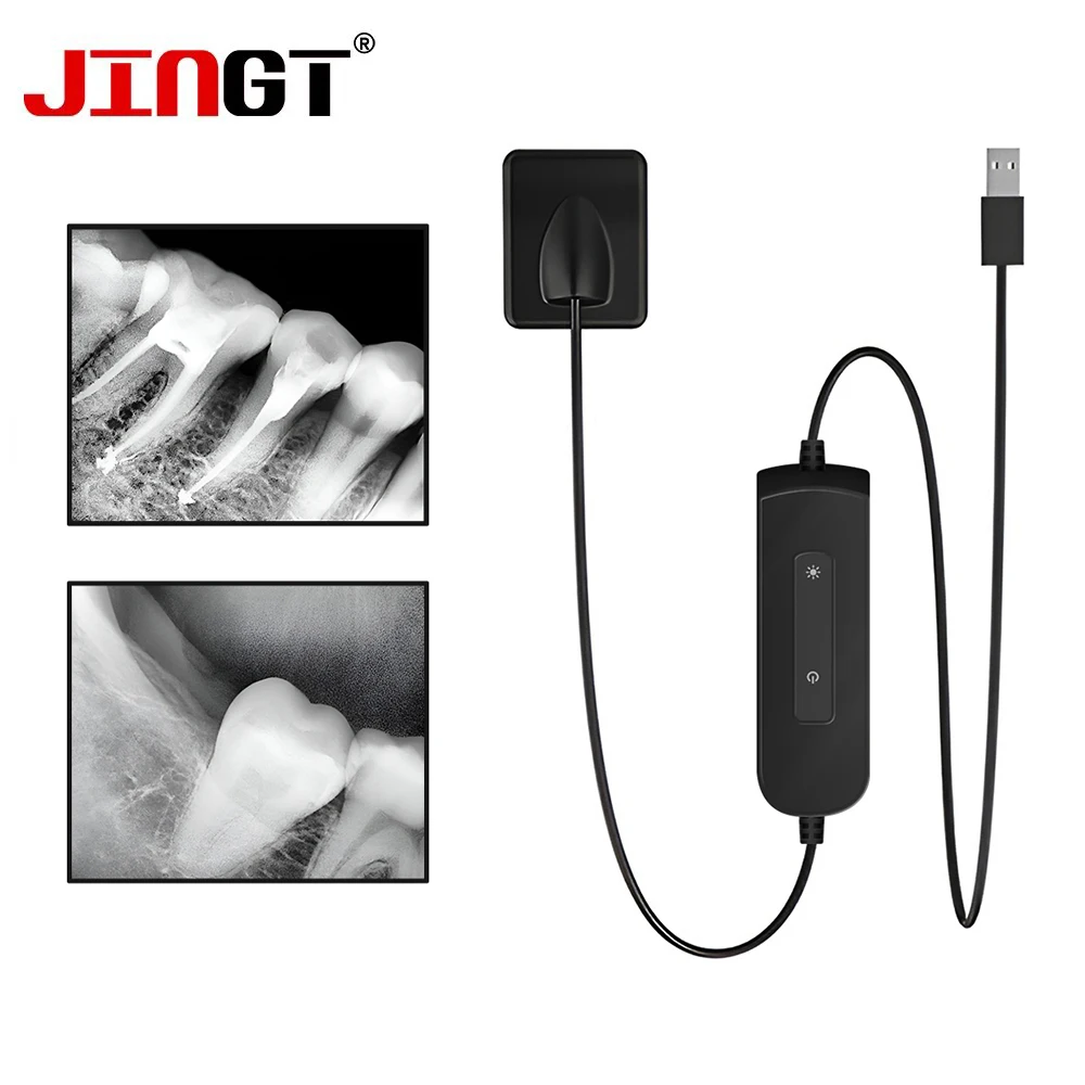JINGT-Dental-Sensor-X-Ray-High-Frequency-Rx-Digital-Intraoral-Digital-System-H-D-Image ...