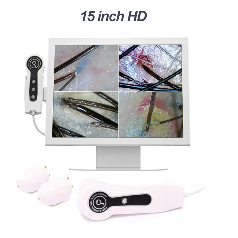 2024-HD-Digital-Skin-Analyzer-Professional-Hair-Scalp-Camera-Detector ...