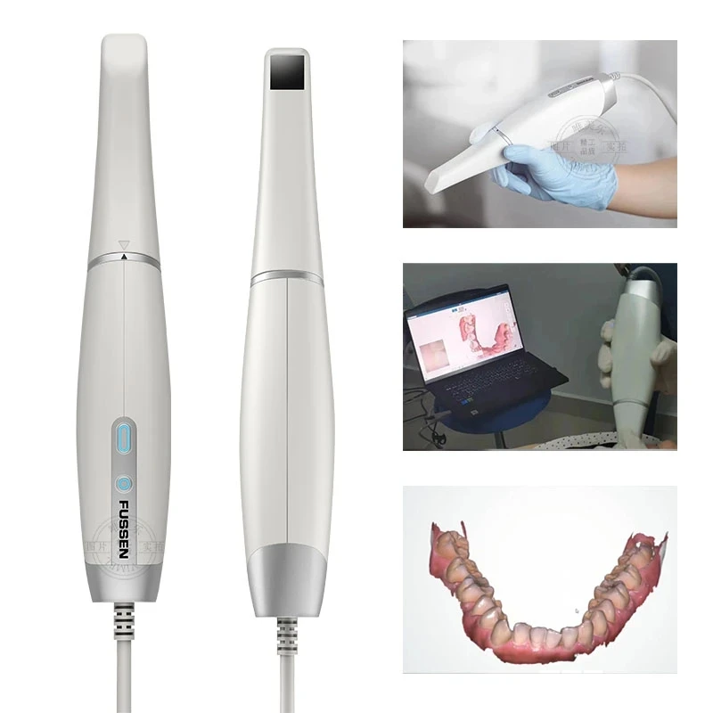 Fussen-3D-Digital-Dental-Intraoral-Oral-Scanner-CAD-Cam-Dentisty-Lab ...