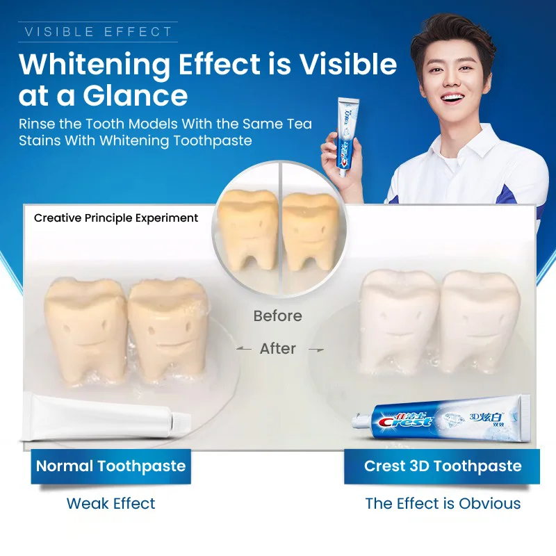 Before And After Crest Teeth Whitening