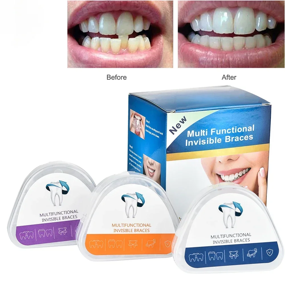 3-Stage Transparent Teeth Aligners - Orthodontic Dental Braces for ...