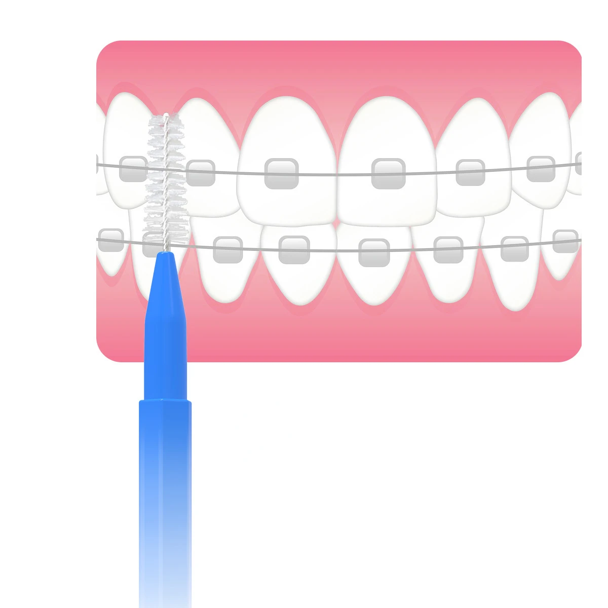 Brosse interdentaire en forme de I,fil dentaire,nettoyage interdentaire ...