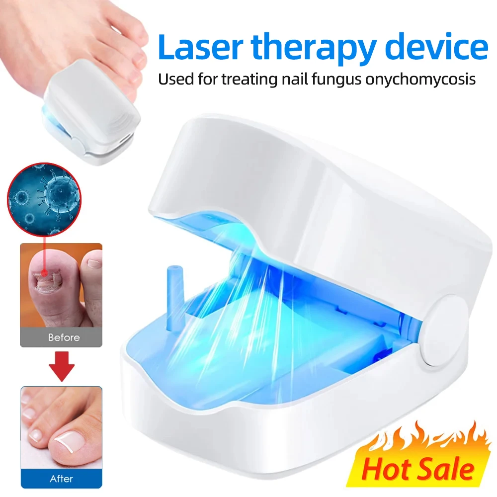 Nail Fungus Cleaning Laser Treatment Device Effectively Remove for ...