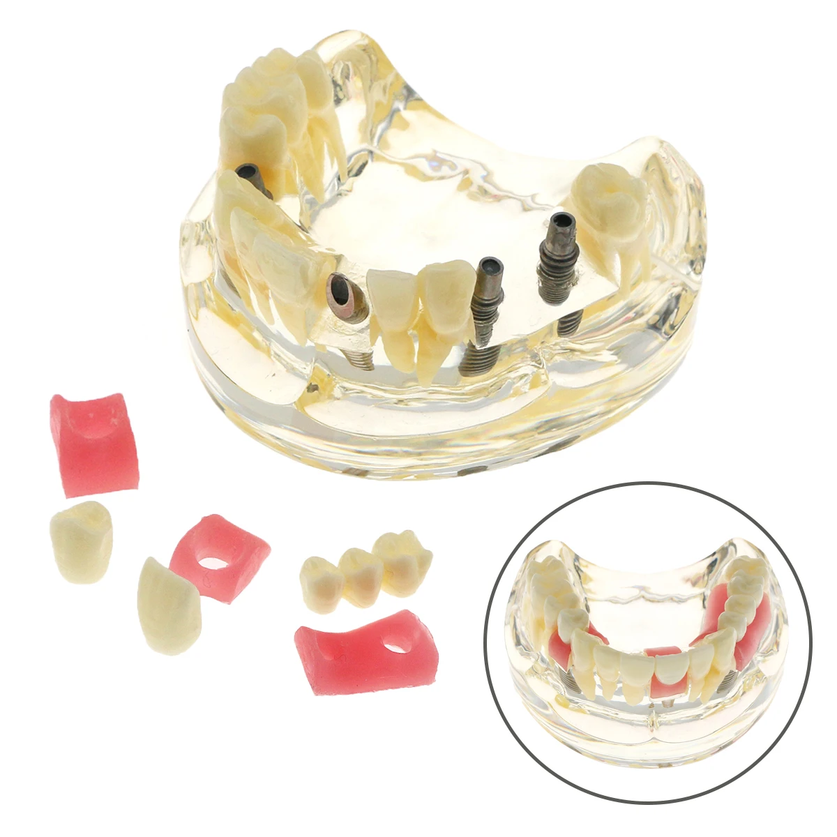 Dental-Teeth-Model-Dentistry-Teaching-Models-For-Dentist-Demo-Implant ...