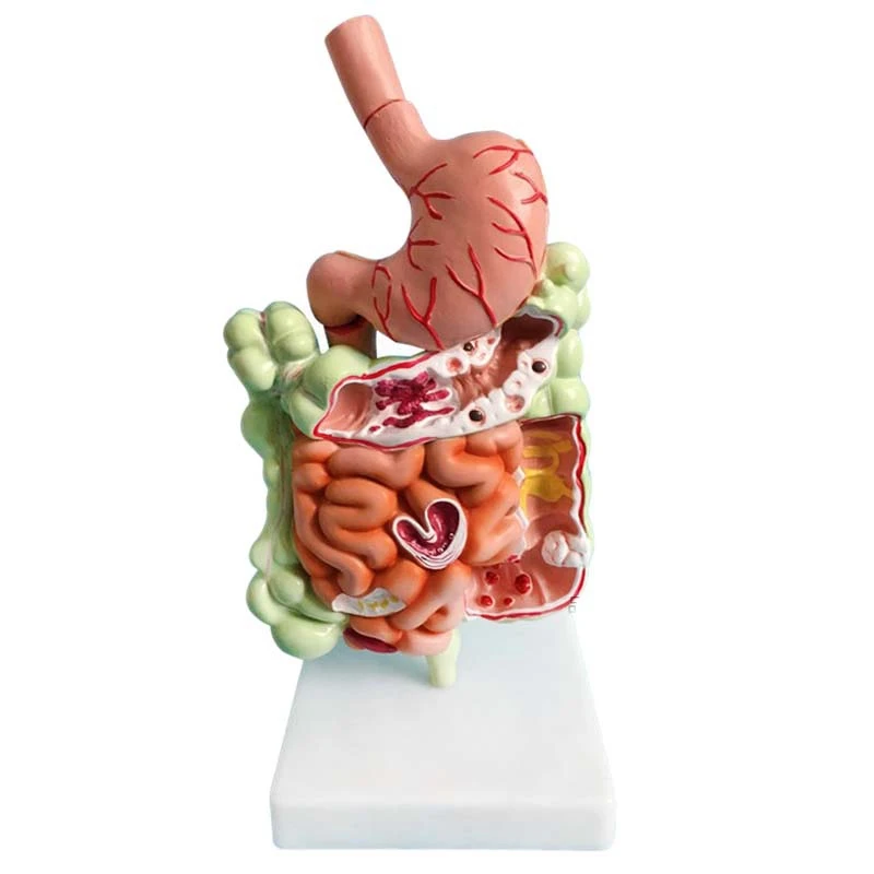 Human-Digestive-System-Model-Stomach-Anatomy-Large-Intestine-Cecum ...