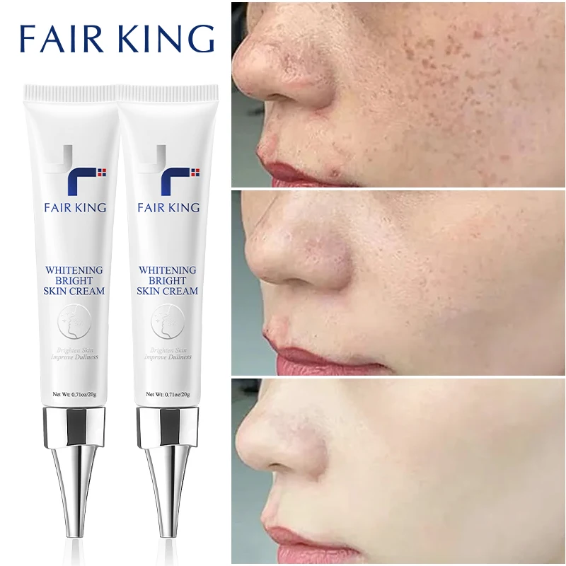 2PCS-Freckle-Cream-Freckle-Removal-Control-Acne-Cream-Skin-Care ...